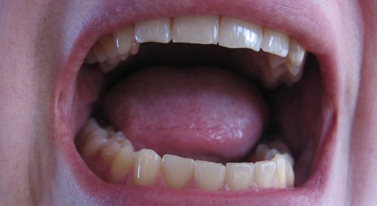 La bestemmia - Alghero Eco